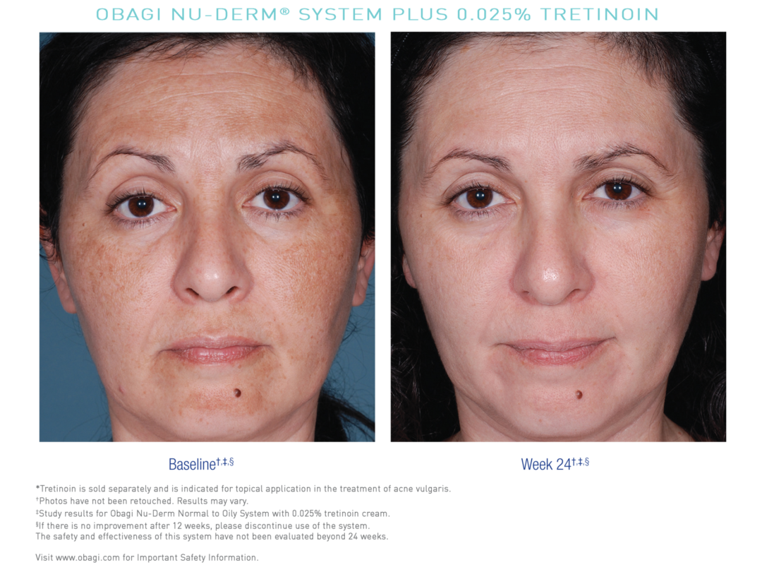 Obagi Nu-Derm System | Dr. Walter Tom